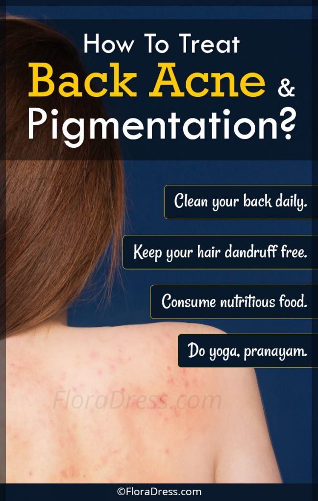 How to Treat Back Acne, Back and Pigmentation With Home Remedies?