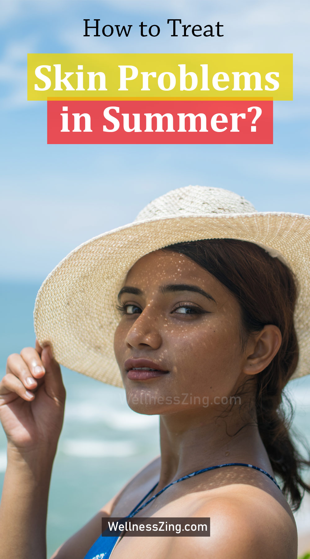 Treat Skin Problems in Summer - WellnessZing
