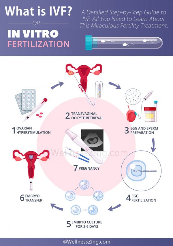What is IVF Treatment, Success Rate, Risks and Complications - WellnessZing